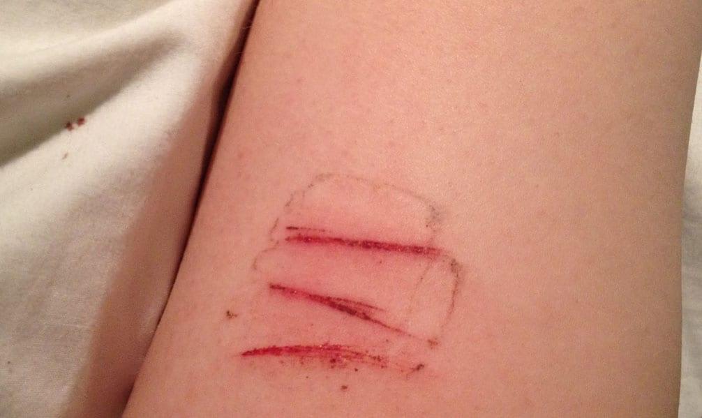 Elaine Bond Help Is Out There For Those That Self harm Gedling Eye Elaine Bond Help Is Out There For Those That Self harm Gedling Eye